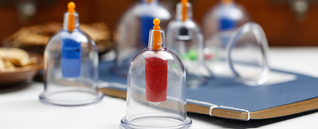 Hijama Cupping Therapy (Natural and Drugless Therapy)